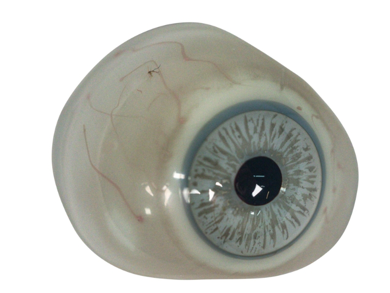 Prosthetic Eyeball